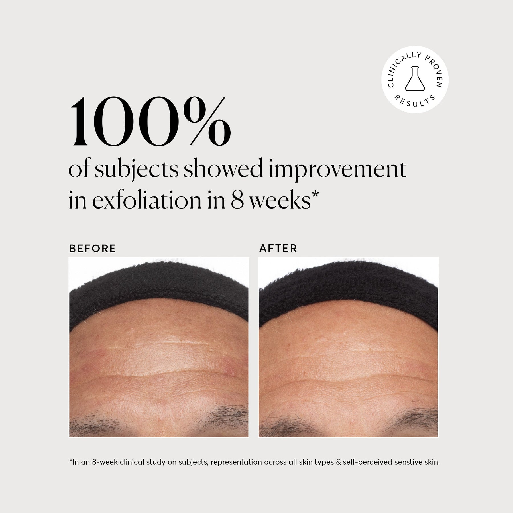 Azelaic Acid Serum 10%