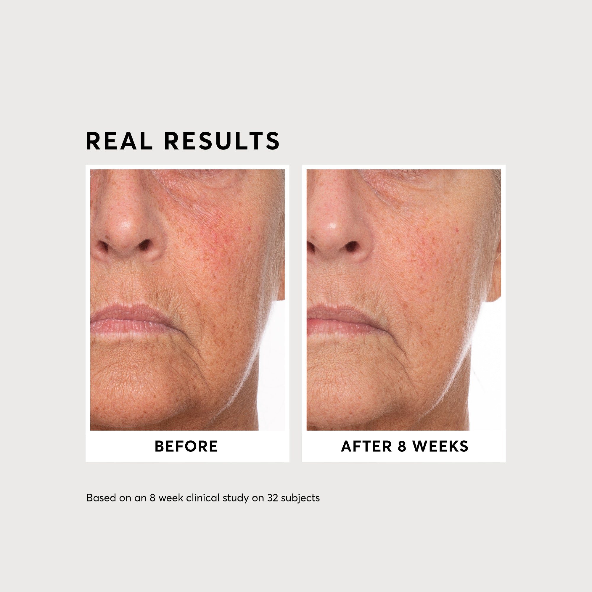 Vitamin C Complex Serum - Naturium