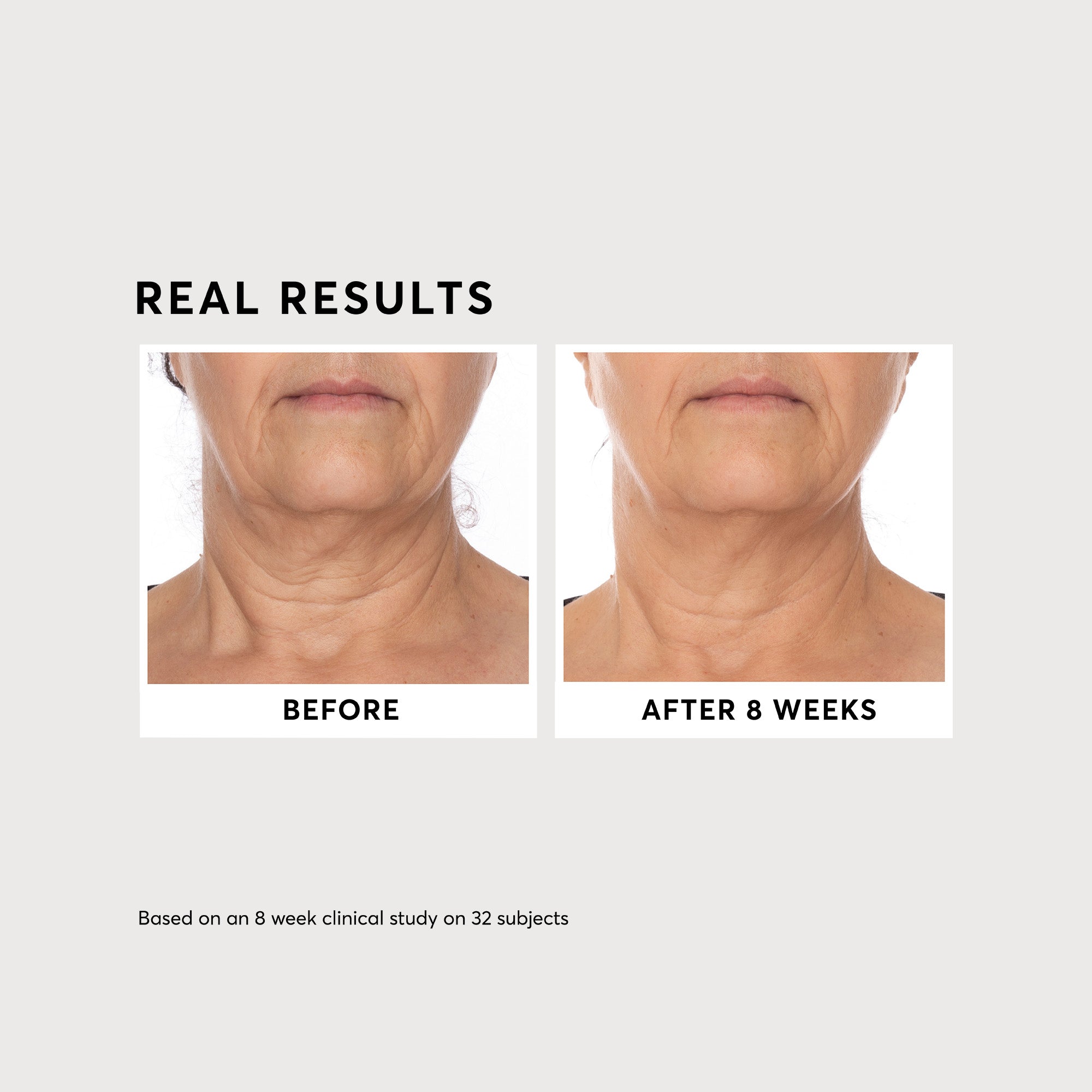 Vitamin C Complex Serum - Naturium